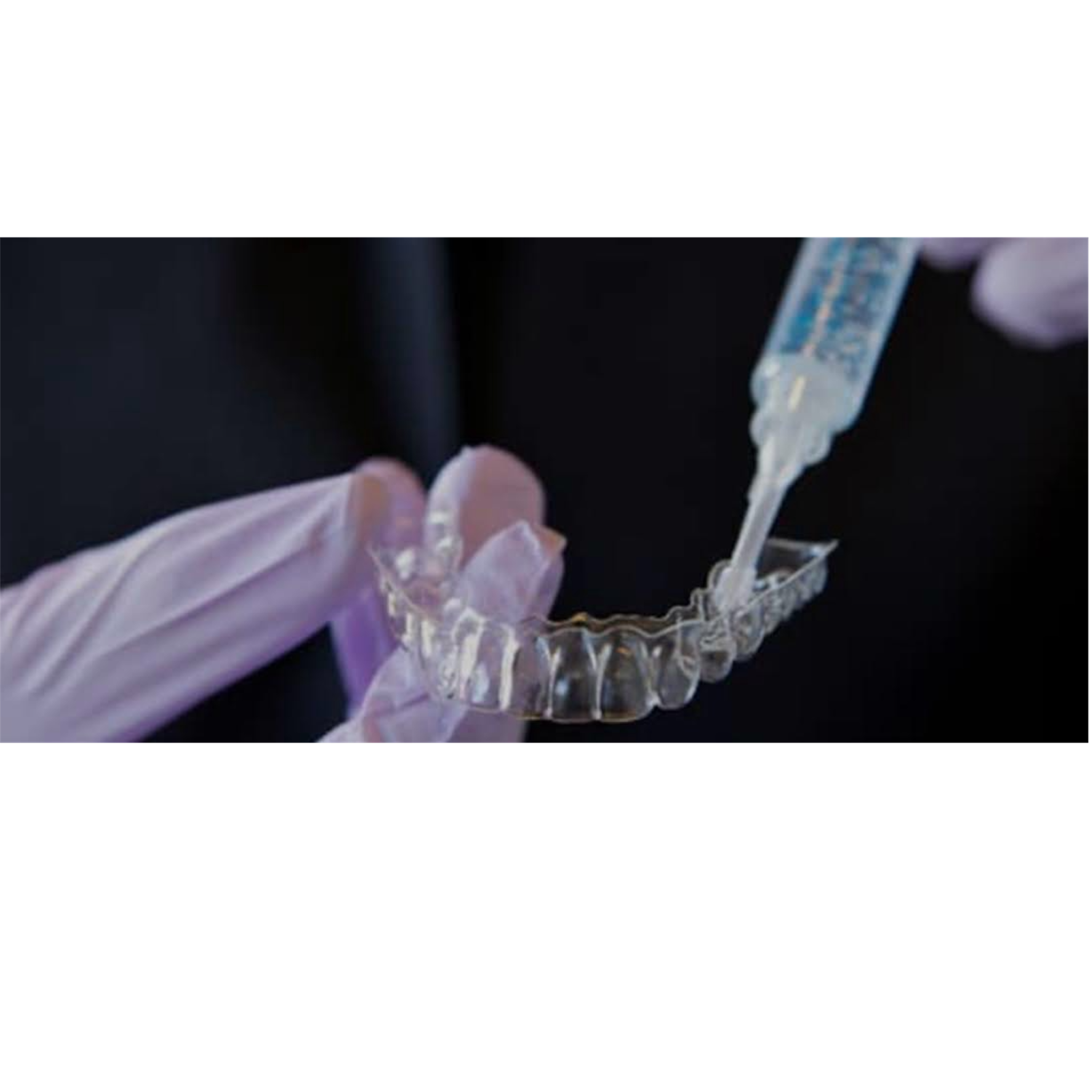 Custom Teeth Whitening Kit | Safe At-Home Whitening System – Teeth ...